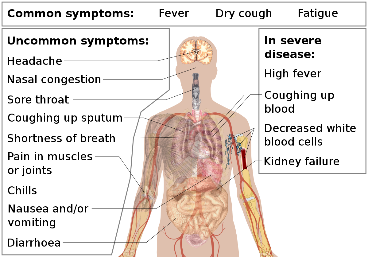 Corona Symptoms, Risks, and Prevention: Complete Guide for COVID 19